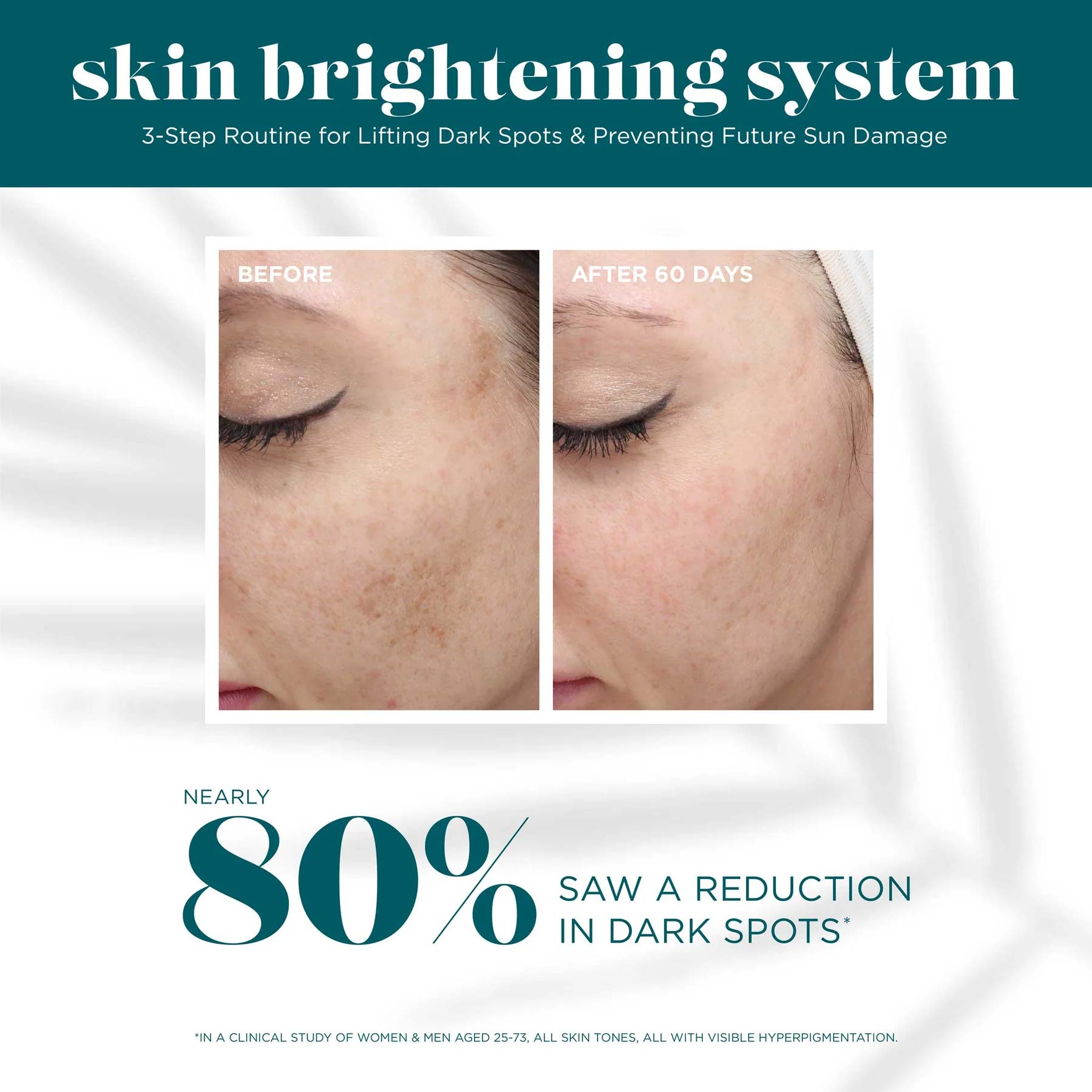 VI Derm Skin Brightening System | Northeast Medical Aesthetics