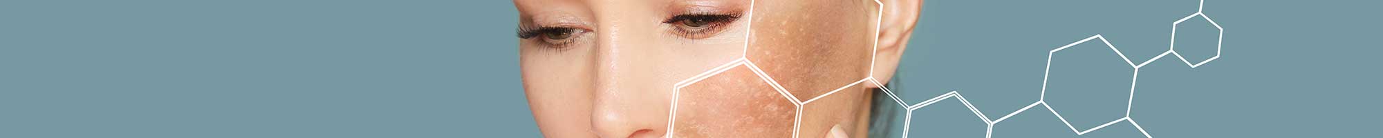 Trauma Surgical Scars - Northeast Medical Aesthetics - Skin Care